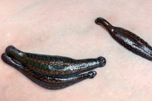 8 Unique Characteristics of Leeches - Wildlife Informer